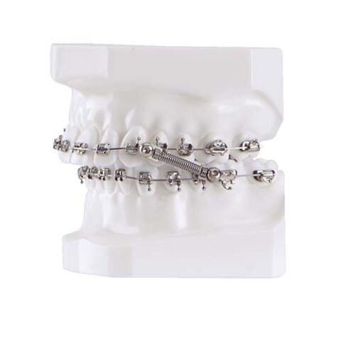 Buy Dynaflex CS5 (1 Patient Kit ) Class II & Class III Corrector